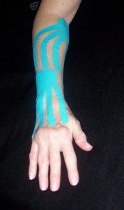 Lymph Taping & Scar Therapy | Lymphatic Massage Works